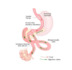 Single Anastomosis Duodenoileal Bypass (SADI) - Weight Loss Surgeon